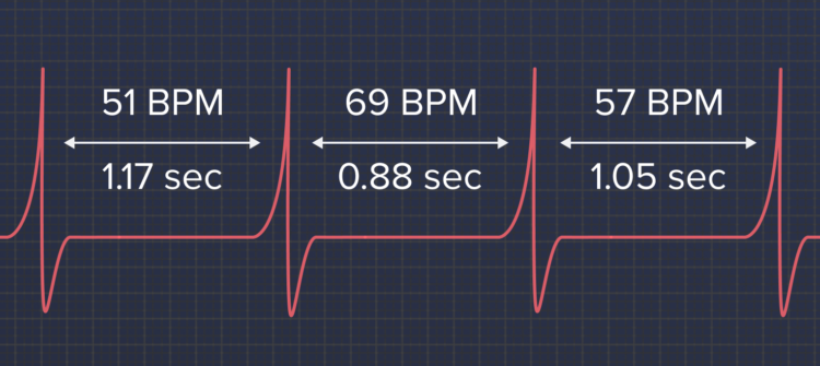What Is Heart Rate Variability? How to understand and check it - Welltory